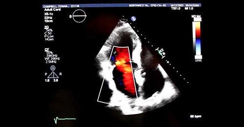 Me and My Echocardiogram
